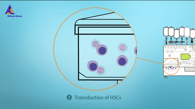 Gene-engineered hematopoietic stem cells | Miltenyi | Miltenyi Biotec ...