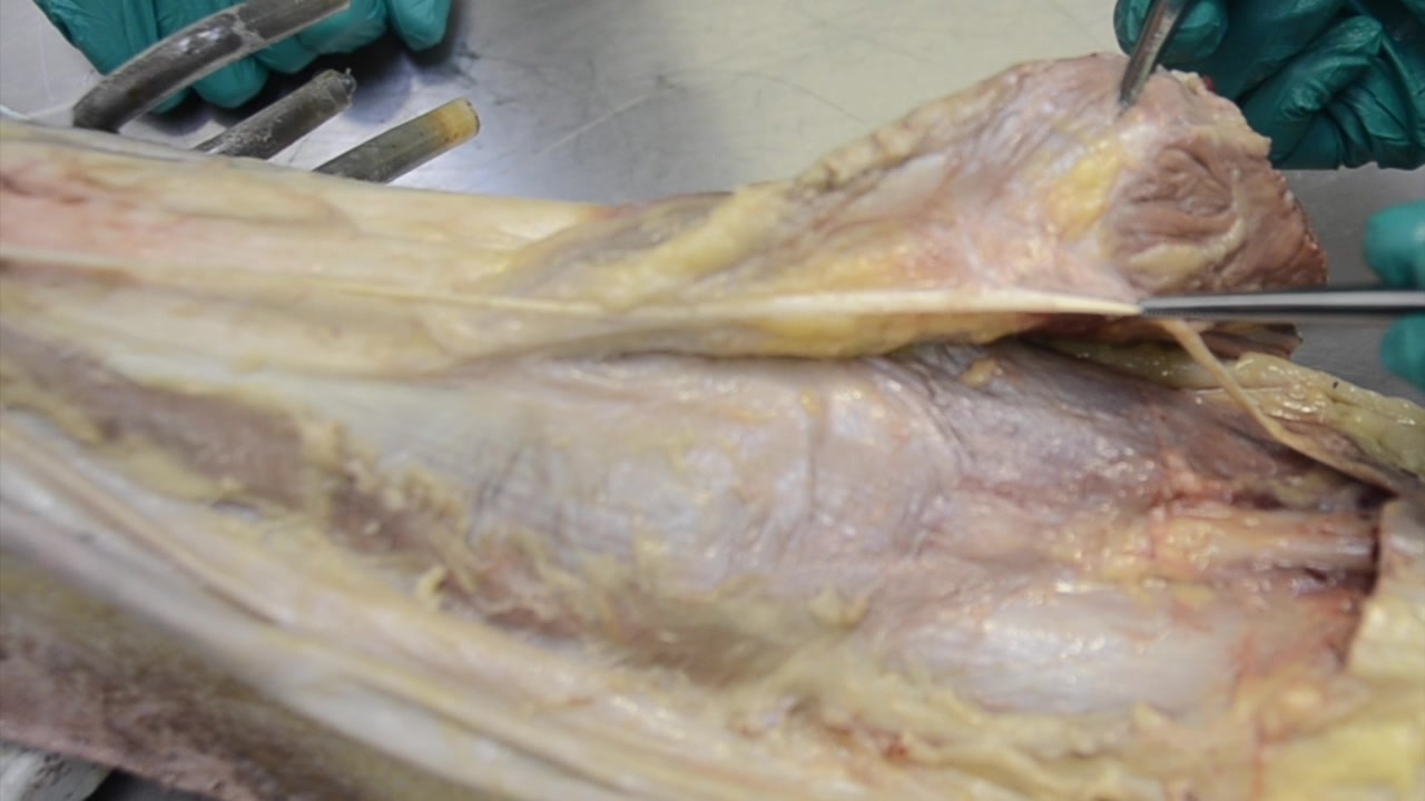 Popliteus Muscle Cat