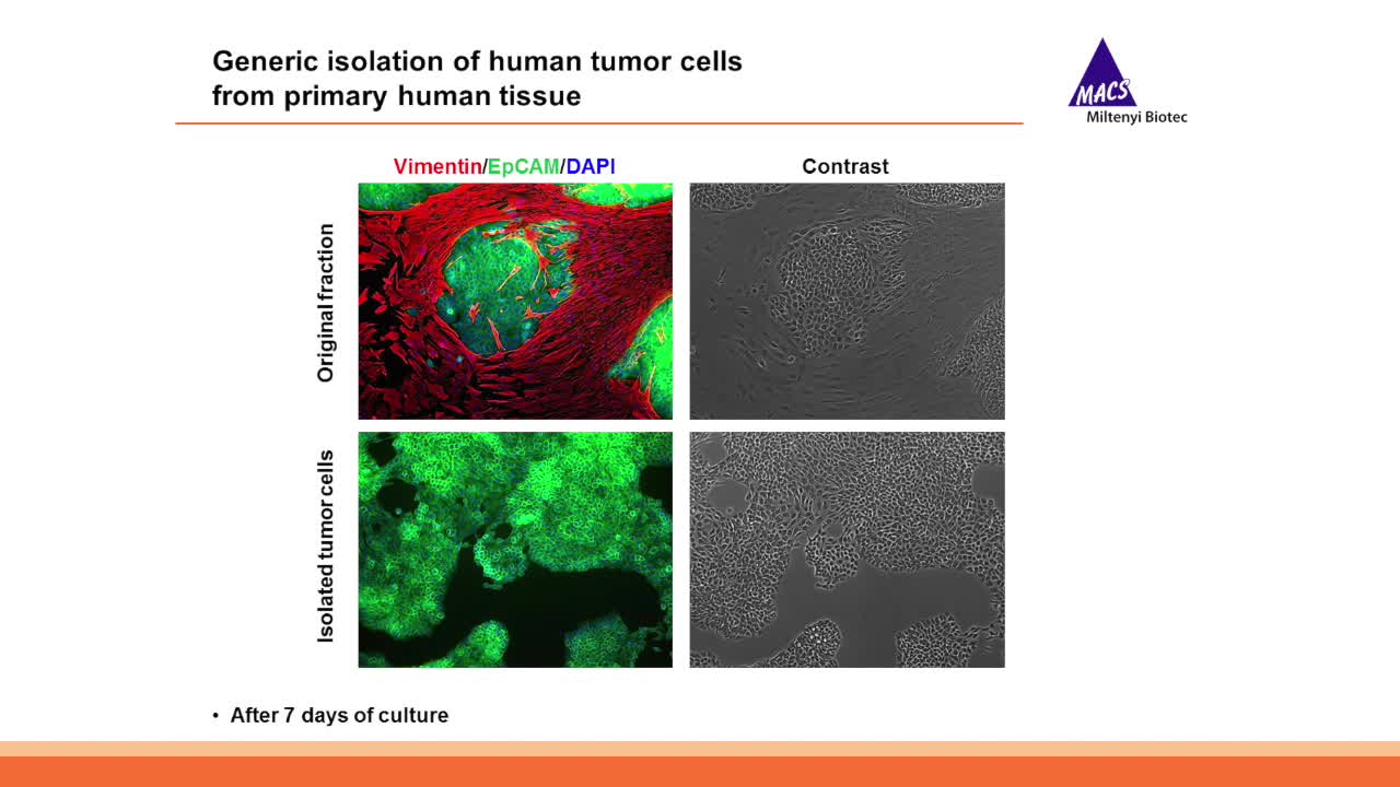 Tumor Cell Isolation | Cancer Cell Analysis | Miltenyi Biotec | Deutschland