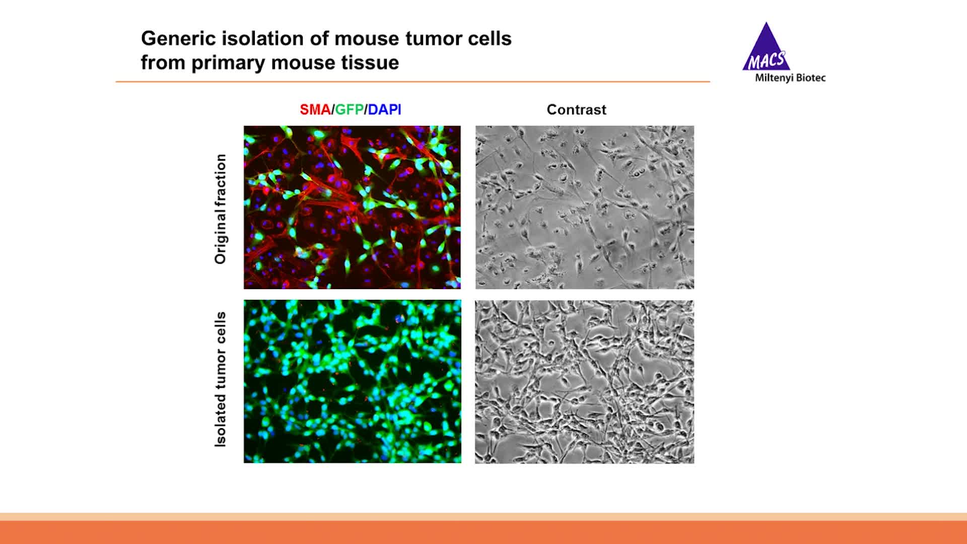 Reliable analysis of tumor subpopulations | Miltenyi Biotec | 대한민국