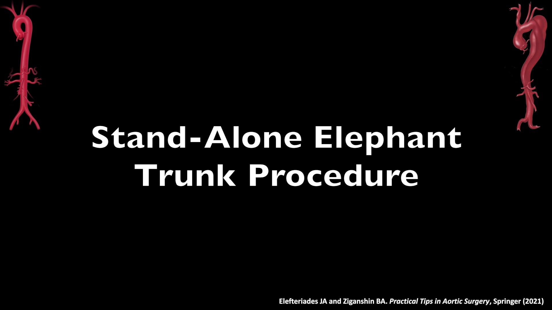 Elephant Trunk Procedure Stages
