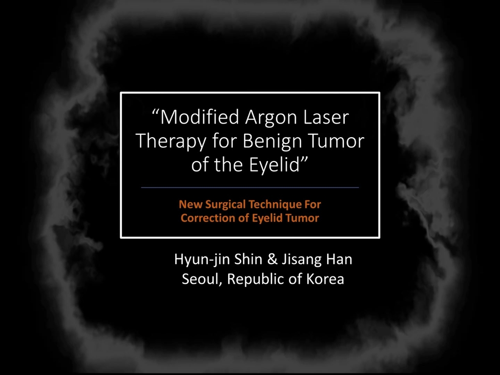 Argon Laser Surgery General