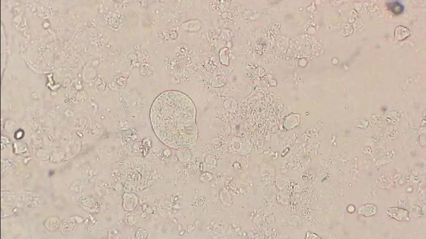 Balantidium Coli Trophozoite 400x