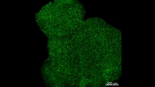 Ki-67 Antibody, anti-human/mouse, REAfinity™ | Miltenyi Biotec | USA