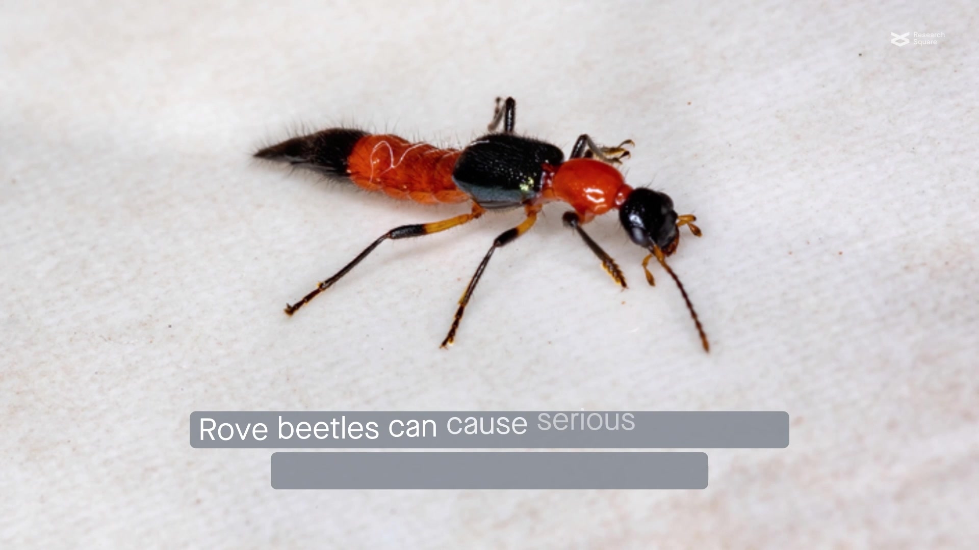Rove Beetle Dermatitis