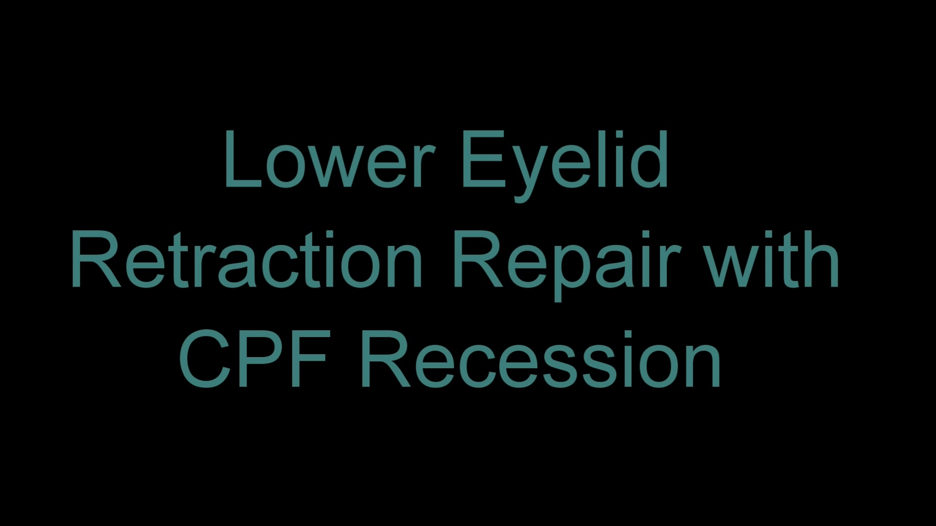 Colliers Sign Eyelid Retraction
