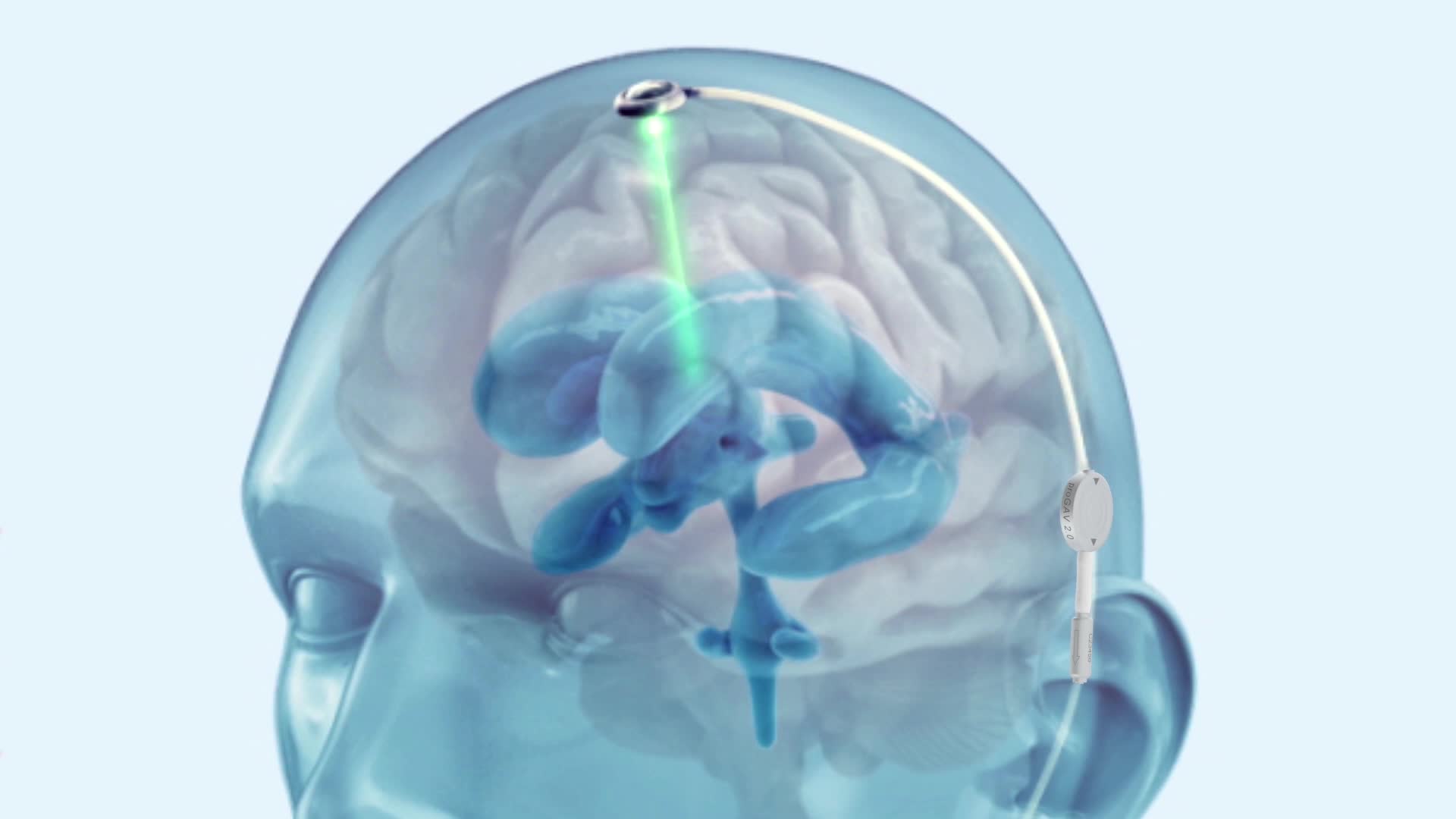 ProGAV, 43% OFF | www.oceanproperty.co.th